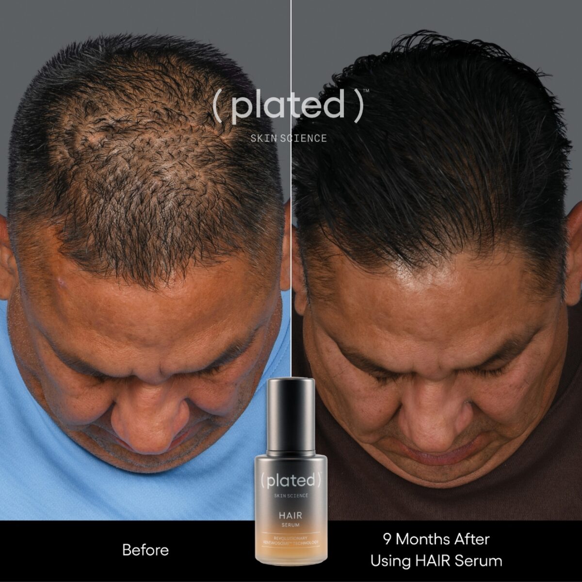 Plated Hair Serum - On Sale Now